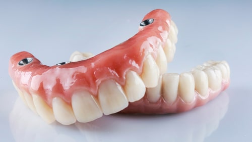 Benefits of Implant Dentures | Mini Dental Implants in Ontario, CA